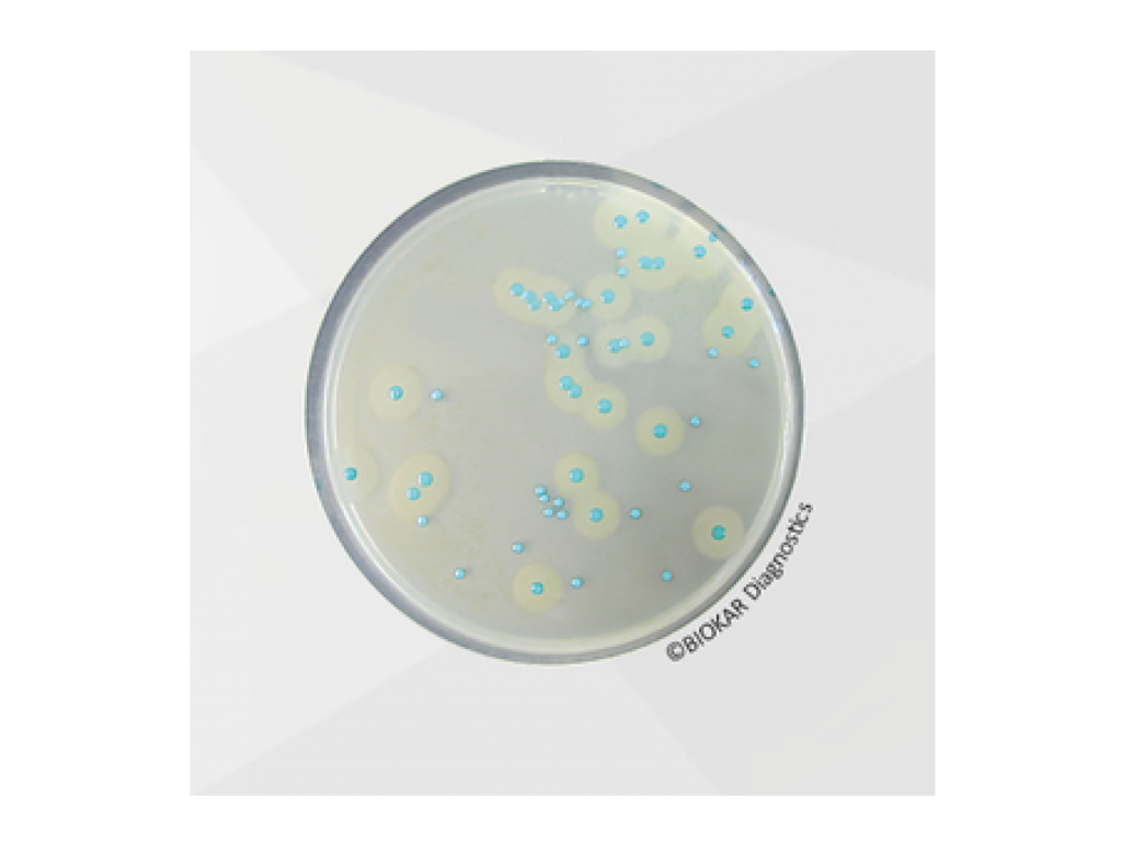 Product in de kijker: Biokar Compass Listeria agar. - FHI, federatie ...